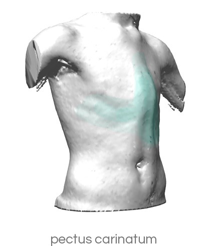 PECTUS – TÓRAX VITAE